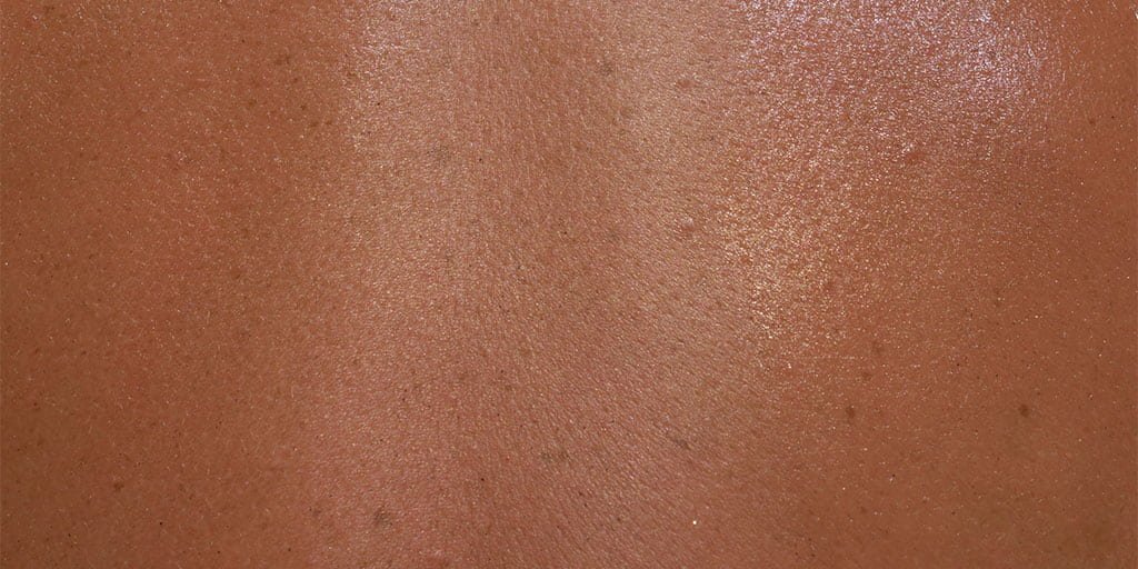 Skin allergy, sensitive skin and reactive skin : causes, treatments ...