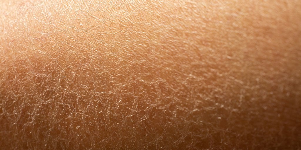 How to treat dehydrated skin | Combat flaking, tightness, and dry skin ...